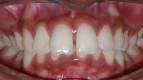 Smile Gallery - Beautiful Smile Dental Surgery