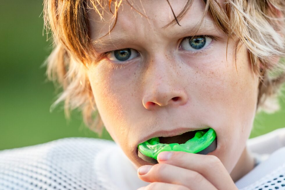Mouth Guards - Beautiful Smile Dental Surgery